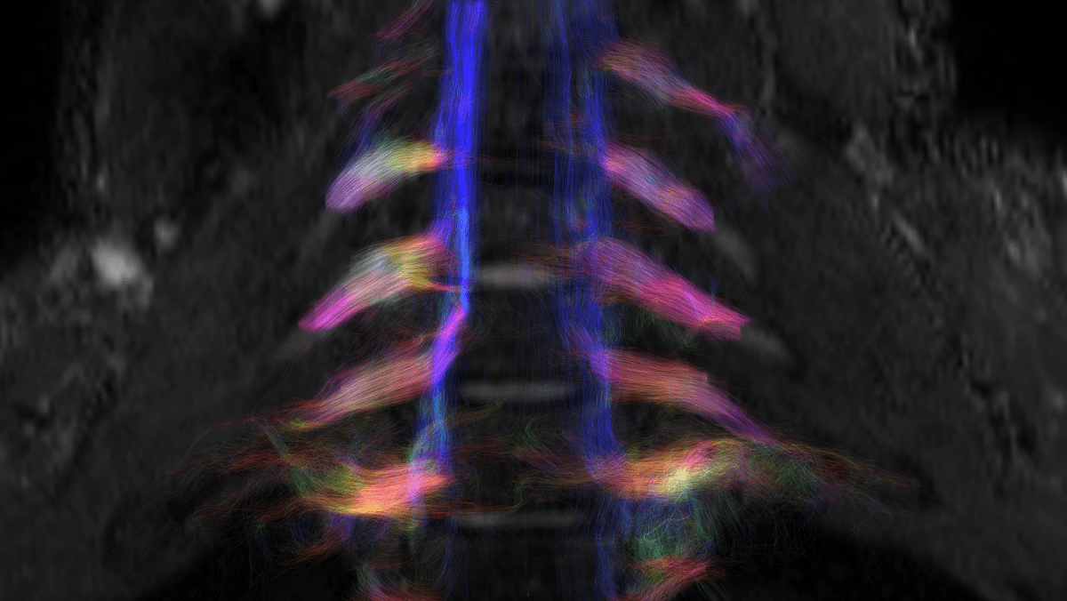Study Update: Use of advanced magnetic resonance imaging to diagnose ...