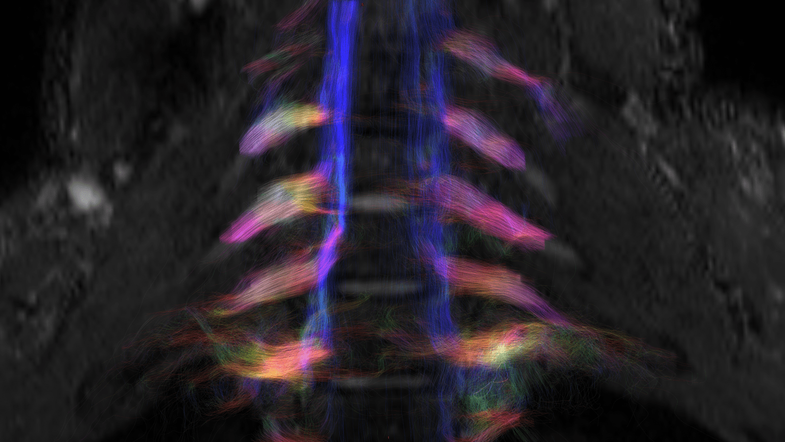Study Update: Use of advanced magnetic resonance imaging to diagnose ...