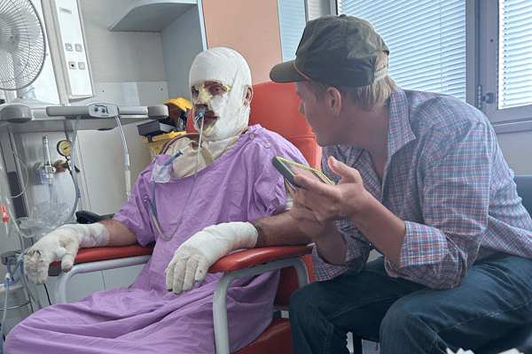 Research shows patients with burn injuries recover better if they are ...