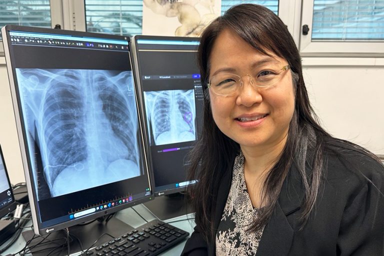 Artificial Intelligence trial underway for radiologists at RBWH | Metro North Health